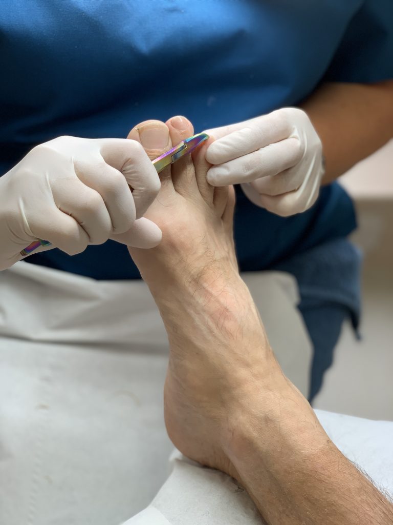 The Best London Chiropody Available - Beauchamp Foot Care - Beauchamp ...